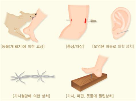 파상풍 백신 접종 비용 및 주기 부작용 증상 및 접종 후 주의사항