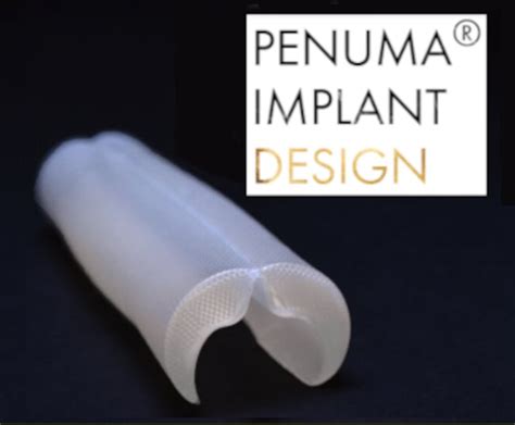 Los Angeles Jury Finds Houston Doctor Misappropriated Penile Implant