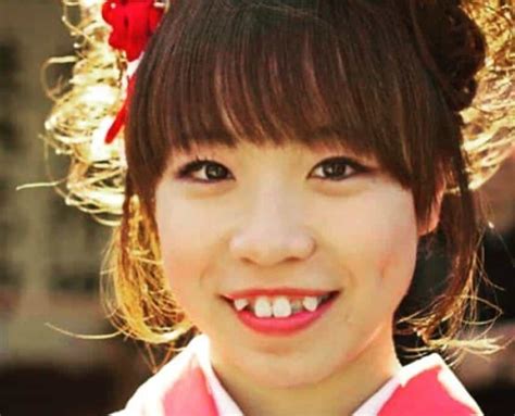 Yaeba Japaneses Attitude Towards Crooked Teeth Japan Truly