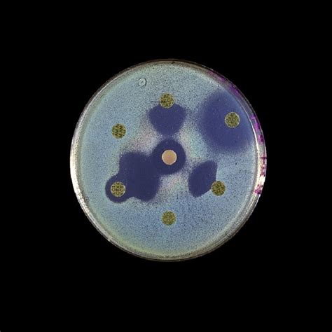 Improving Bacterial Strain Classification For More Effective Surveillance