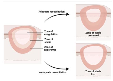 This Figure Shows The Structure Of Flavonoids Which Are A Class Of Download Scientific Diagram