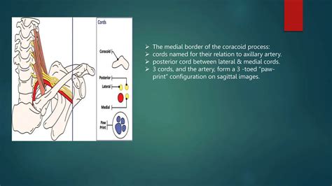 Imaging Of Brachial Plexusradiology Pptx Pptx Imaging Of Brachial Plexusradiology Pptx Pptx