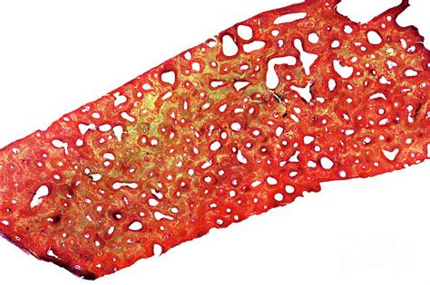 Decalcified Bone Photograph By Dr Keith Wheelerscience Photo Library