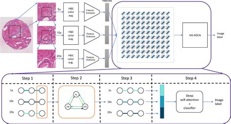 Multi Scale Relational Graph Convolutional Network For Multiple Instance Learning In