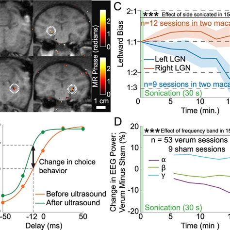 Chronic Modulation Of Primate Deep Brain Circuits With Ultrasound Is
