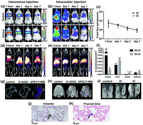 Multi Modal Imaging Probe For Assessing The Efficiency Of Stem Cell