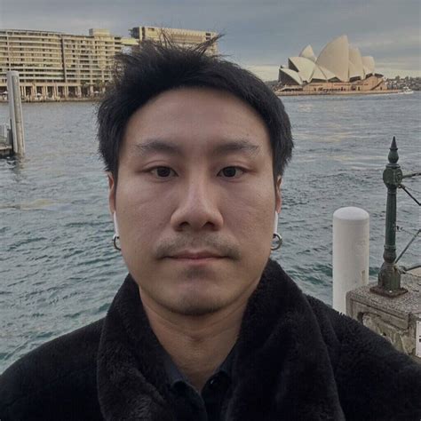 Review Cases Foreign Customer From Austria 34 Years Old Mp Hair Clinic