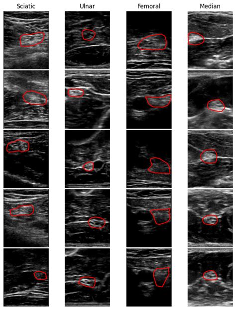 Datasets — Gcpds Image Segmentation Documentation