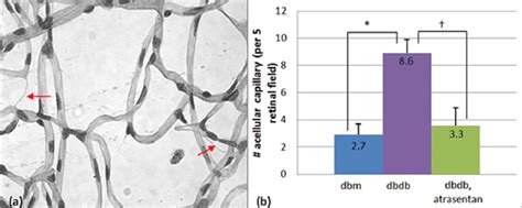 Trypsin Digest And Acellular Capillaries Per Five Retinal Fields