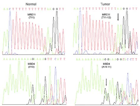 Dna Sequencing Of The Microsatellite Instability Target Genes Meiotic