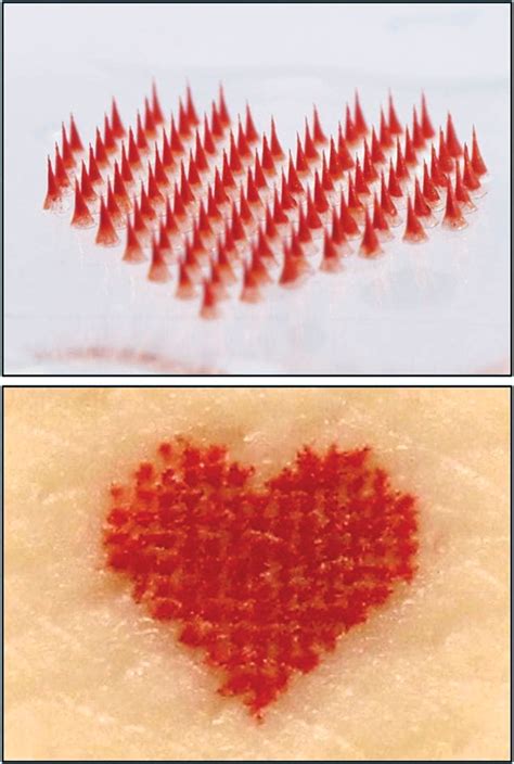 Do It Yourself Microneedle Specialty Fabrics Review