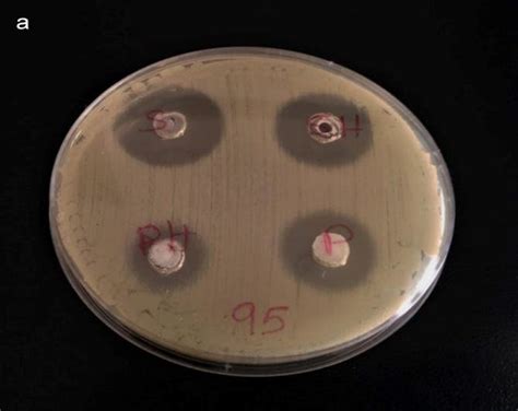 Agar Diffusion Method Showed The Antibacterial Activity Of Different Download Scientific