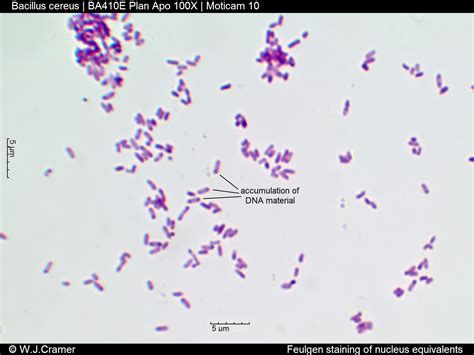 Motic Europe Blog Feulgen Stain Still Indispensable For Microscopic