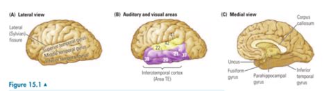 Ch 15 Temporal Lobes And Networks Flashcards Quizlet