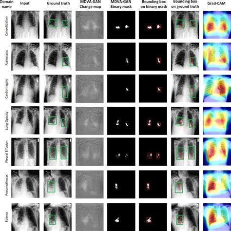 Visual Attribution Healthy Image With Disease Label Download
