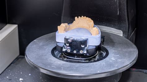 3d Printed Shell Complete Dentures For Implant Planning