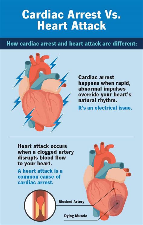 Sudden Cardiac Arrest Causes And Symptoms Wockr
