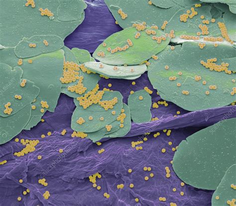 Silver Ink On Newspaper Sem Stock Image C0584979 Science Photo