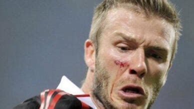 Beckham Surgery A Success But Surgeon Rules Out World Cup Spot France 24
