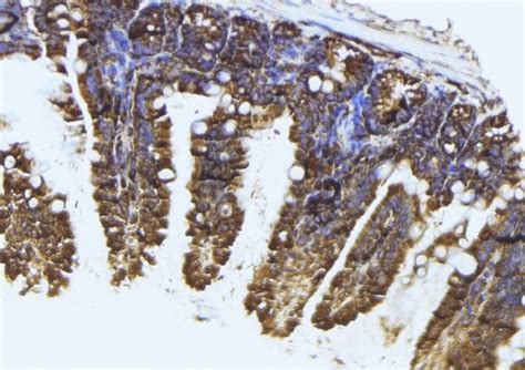 Phospho Lrp6 Thr1479 Polyclonal Antibody Invitrogen™ 100 μl