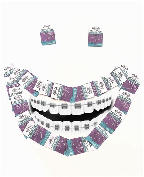 That Face When You Ask The Orthodontic Assistant For Some More Of Those