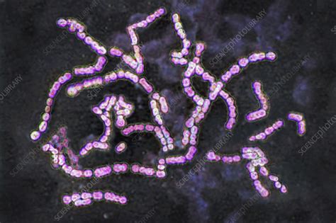 Group A Streptococci Pyogenes Bacteria Light Micrograph Stock Image C0610037 Science
