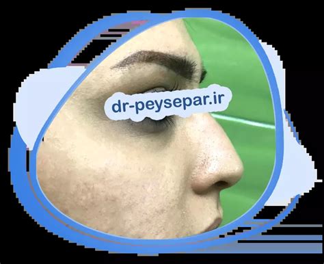 دکتر جواد پی‌سپار متخصص جراحی زیبایی در اهواز با تجربه و نمونه کارهای
