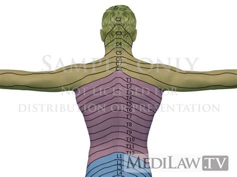 Cervical Dermatome Map Dermatome Map