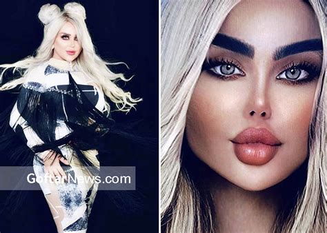 Baghdad Born Dalia Naeem 29 Ive Had 43 Cosmetic Procedures Page 5