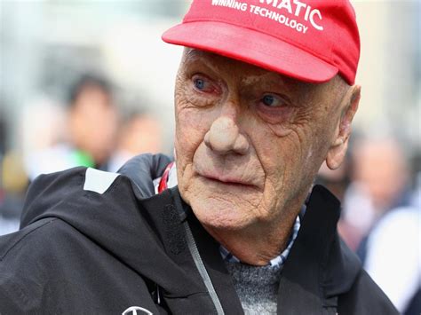 Niki Lauda Before And After