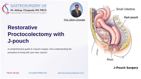 J Pouch Surgery Restorative Proctocolectomy Ibd Treatment Dr