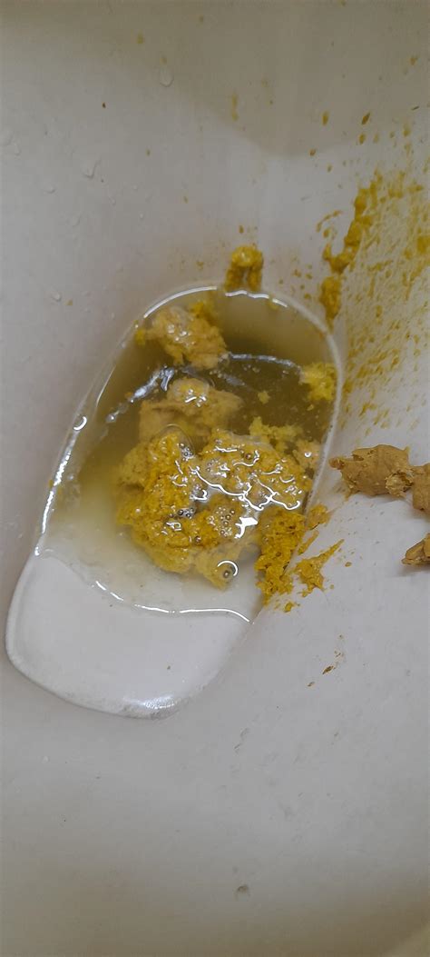 Toilet Poop Rpoop