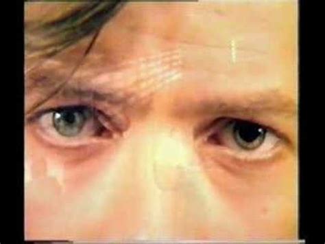 David Bowie Space Oddity At Thames 1979 David Bowie Pupils David Bowie Button Eyes Ziggy