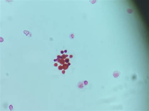 Csf Gram Stain Rmedlabprofessionals