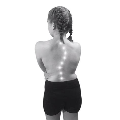 Elizabeth Taylor S Scoliosis Story Strauss Scoliosis