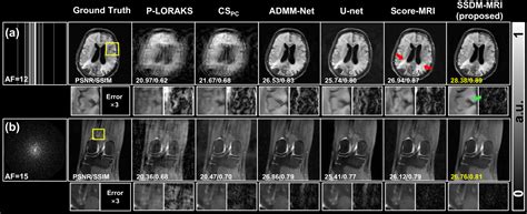 Highly Undersampled Mri Reconstruction Via A Single Posterior Sampling