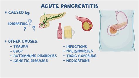 Acute Pancreatitis Rethinking Acute Pancreatitis In The Ed Emottawa