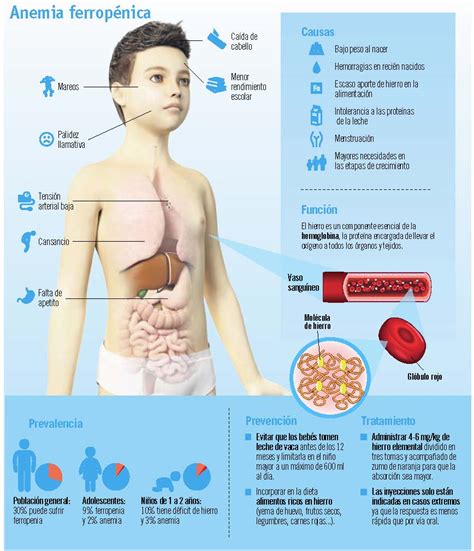 Ferropenia Principal Causa De Anemia Infantil