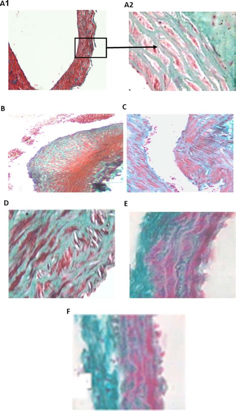 Photomicrograph Of Thoracic Aorta Sections In Different Studied Groups