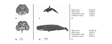 An Illustration Of The Difference In Cerebellum Size Between 1 Adult