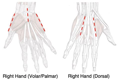 Upper Extremity Fasciotomy Trauma Icu