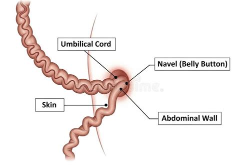 Abdomen Diagram With Belly Button