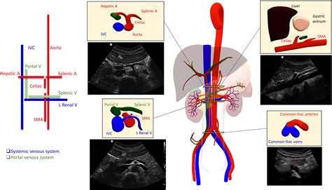 Vascular Point Of Care Ultrasound Medical Clinics