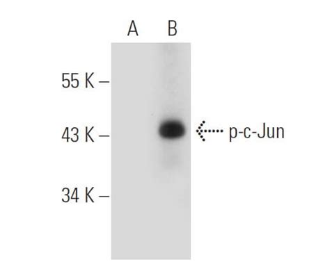 Anti P C Jun Antibody C J 4c41 Scbt Santa Cruz Biotechnology