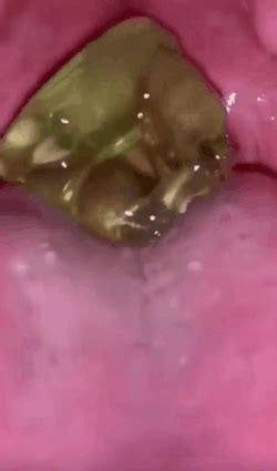 Swallowing Wikipedia