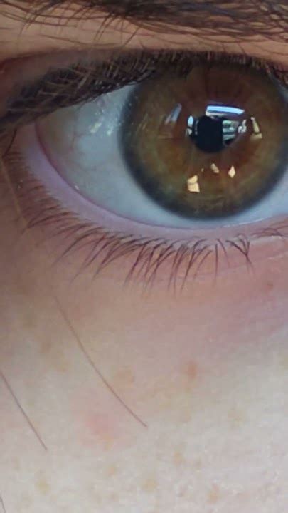 I Have 2 Diff Eye Shapes😭 Youtube