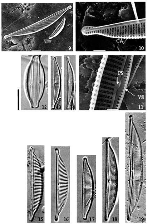 Amphora Taxa Sem Scale Bars Fig 9 5 Pm Fig 10 2 Pm Fig 11