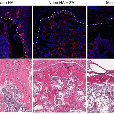 Fluorescent Trap Staining Of Bone Nodules Reveals Increased Trap Download Scientific Diagram