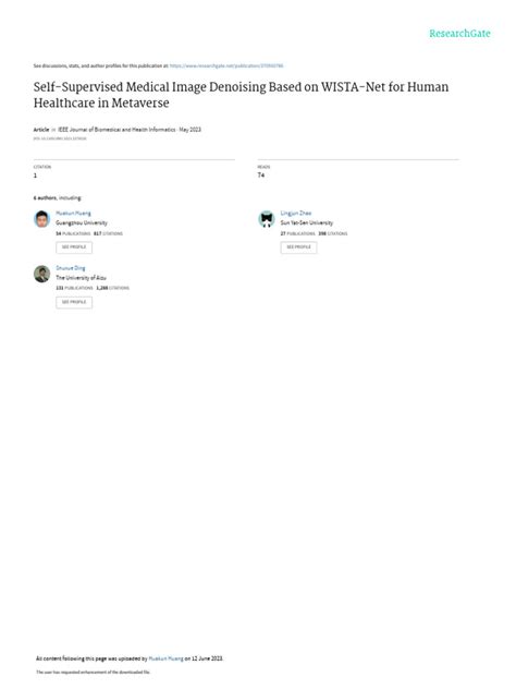 Self Supervised Medical Image Denoising Based On Wista Net For Human