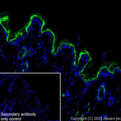 Anti Loricrin Antibody [rm1090] Ab315352 Abcam